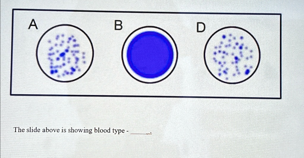 SOLVED: A The slide above is showing blood type - A B D The slide above ...