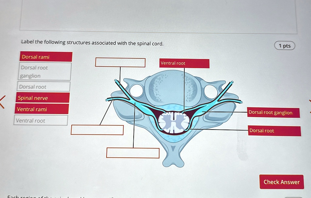Label the following structures associated with the spinal cord. Dorsal rami Dorsal root ganglion ...
