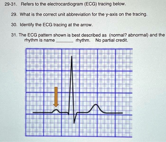 29-31. Refers to the electrocardiogram (ECG) tracing below. 29. What is ...