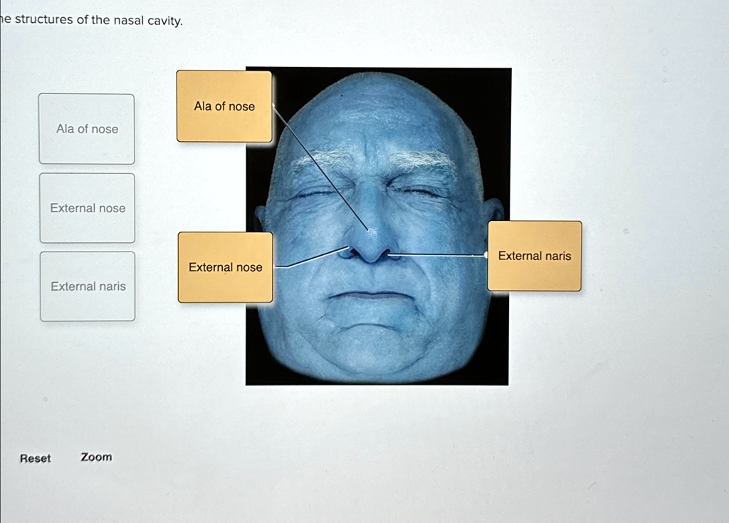 he structures of the nasal cavity. Reset Zoom e structures of the nasal ...