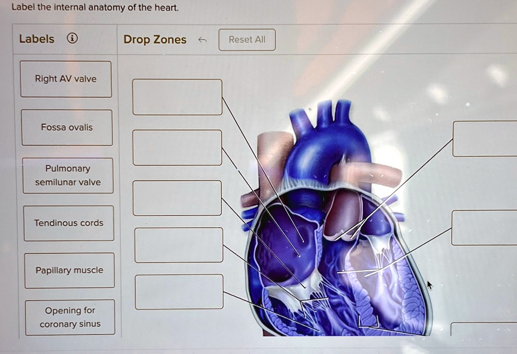 Label the internal anatomy of the heart. Labels Right AV...