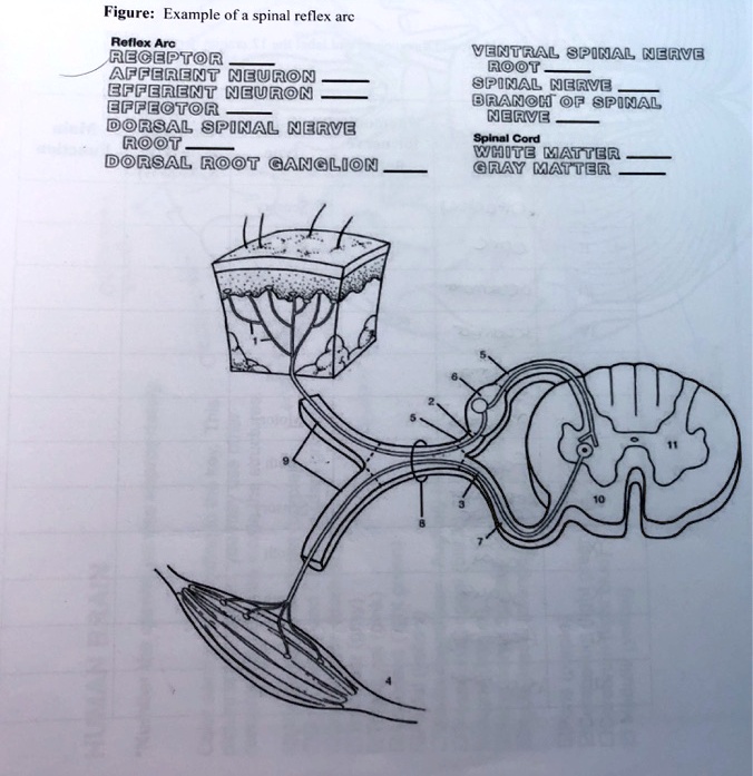 Figure: Example of a spinal reflex arc Reflex Arc RECEPTOR AFFERENT ...