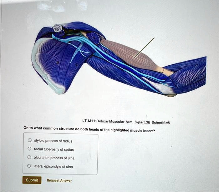 SOLVED: Texts: LT-M11: Deluxe Muscular Arm, 6-part. 3B Scientific. On ...