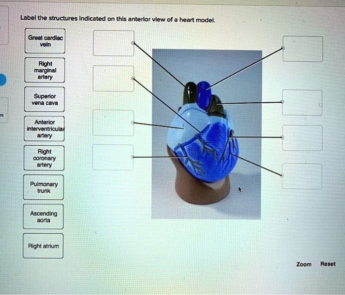Label the structures indicated on this anterior view of a heart model ...