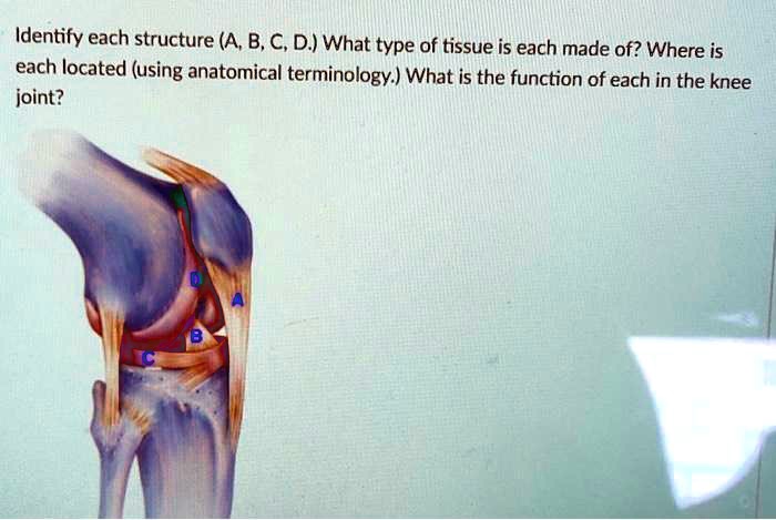 Identify each structure A, B, C, and D. What type of tissue is each ...