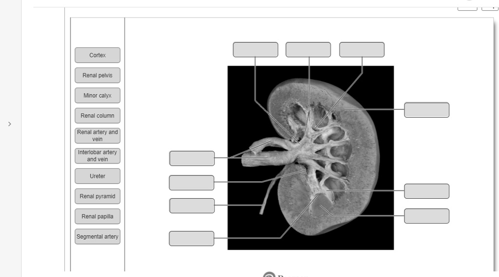 SOLVED: Cortex Renal pelvis Minor calyx Renal column Renal artery and vein Interlobar artery and ...