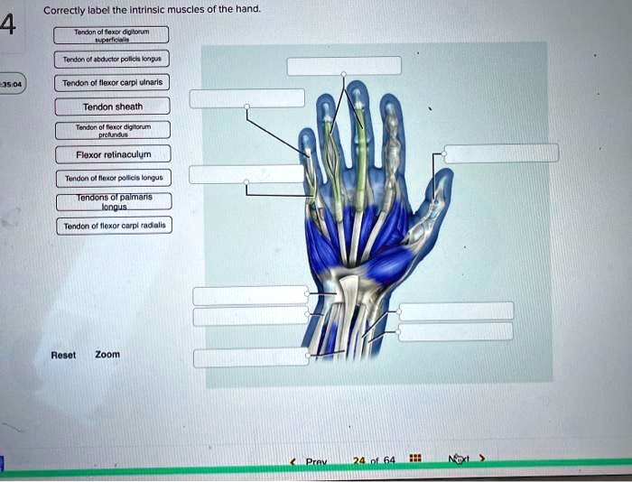 [GET ANSWER] 4 35:04 Correctly label the intrinsic muscles of the hand ...