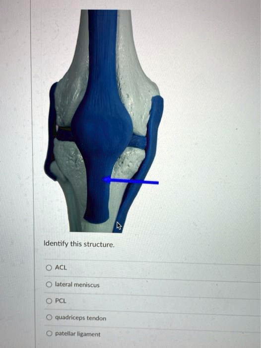 SOLVED:Identify this structure ACL Iateral menlscus PCL quadriceps ...