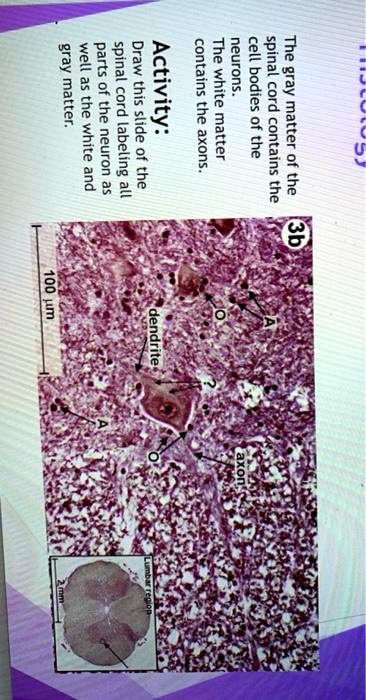 The gray matter of the spinal cord contains the cell bodies of the ...