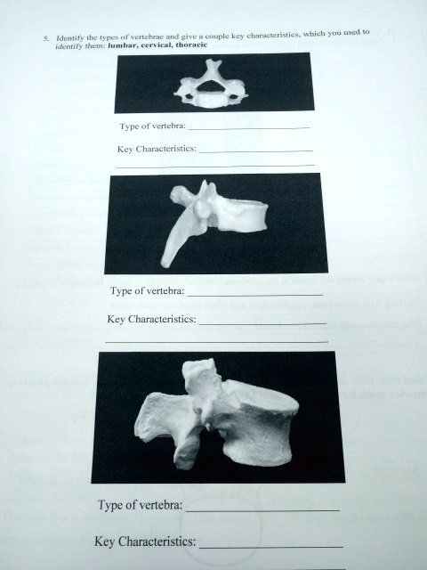 SOLVED: Identify the types of vertebrae and give a couple of key ...