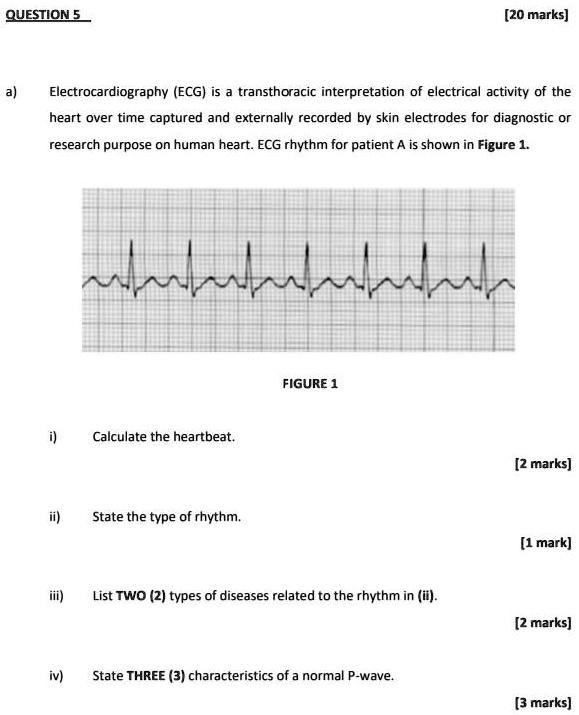 QUESTION 5 [20 marks] a) Electrocardiography (ECG) is a transthoracic ...