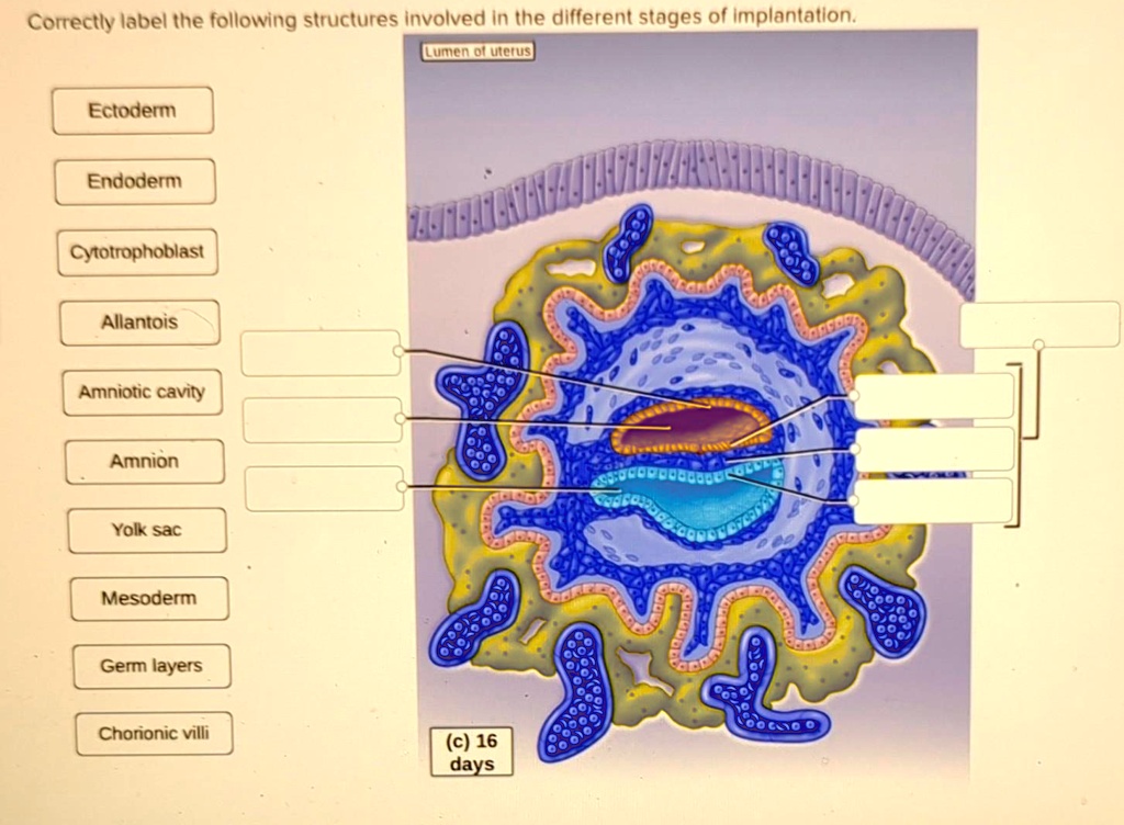 Correctly label the following structures involved in the different ...
