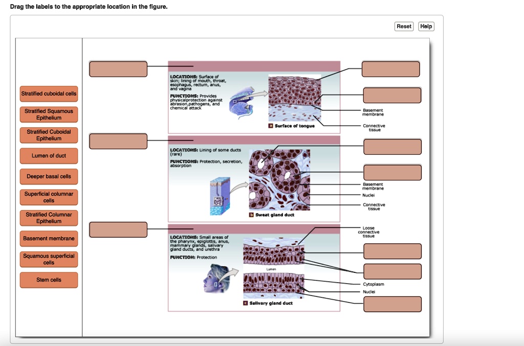 SOLVED: Texts: Drag the labels to the appropriate location in the ...