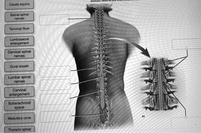 SOLVED: Cauda equina Sacral spinal nerves Terminal filum Lumbosacral ...