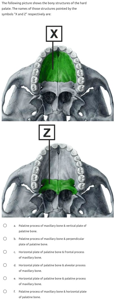 SOLVED: The following picture shows the bony structures of the hard ...