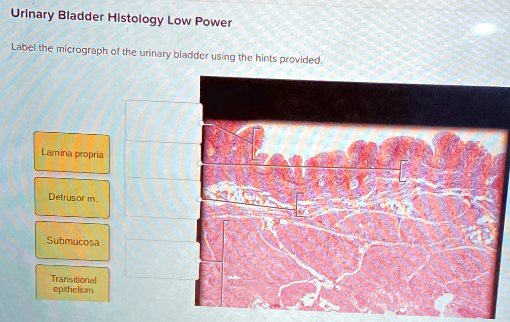 Urinary Bladder Histology Low Power Label the micrograph of the urinary ...