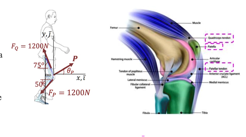 Texts: The upper leg muscle (quadriceps) tendon and patellar tendon ...