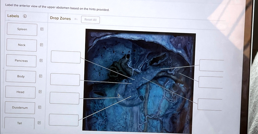 Label the anterior view of the upper abdomen based on the hints ...