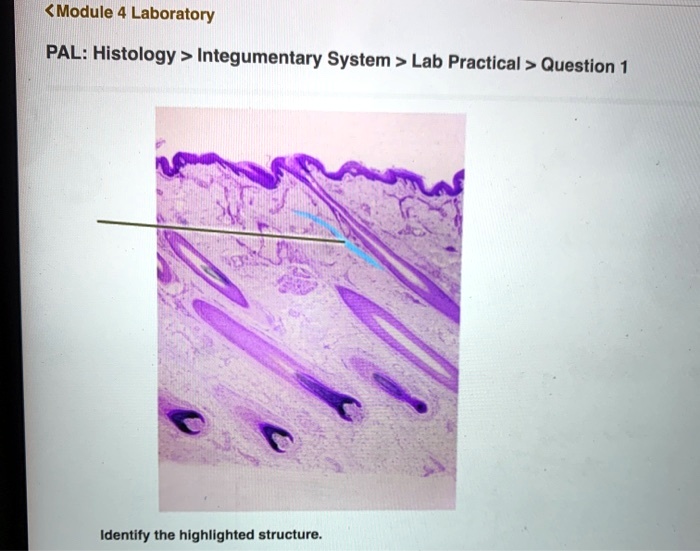 Integumentary System > Lab Practical > Question 1 Identify the highlighted structure.