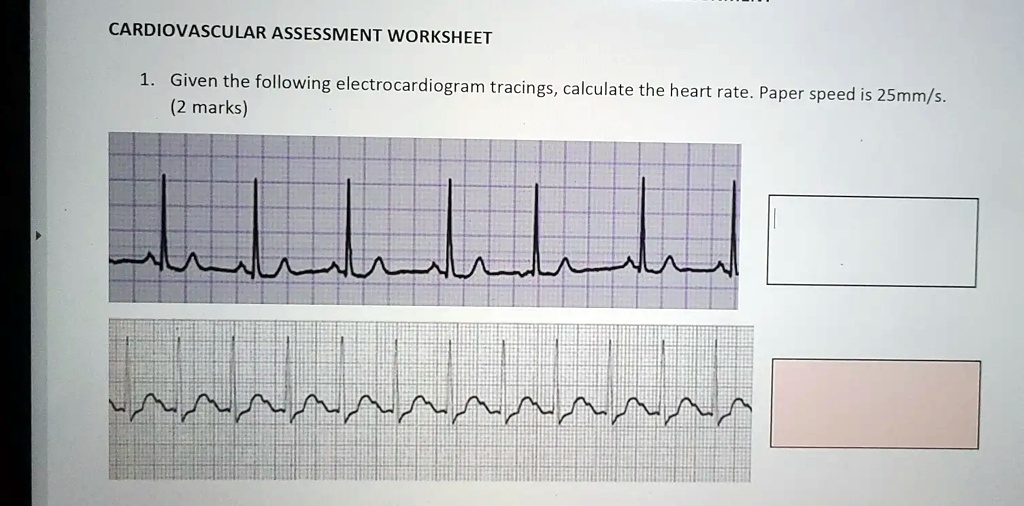 CARDIOVASCULAR ASSESSMENT WORKSHEET 1. Given the following ...