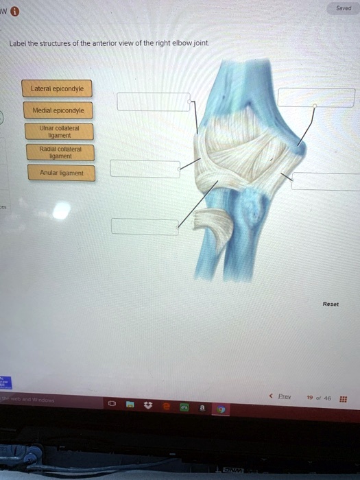 SOLVED: Label the structures of the anterior view of the right elbow joint. Lateral epicondyle ...