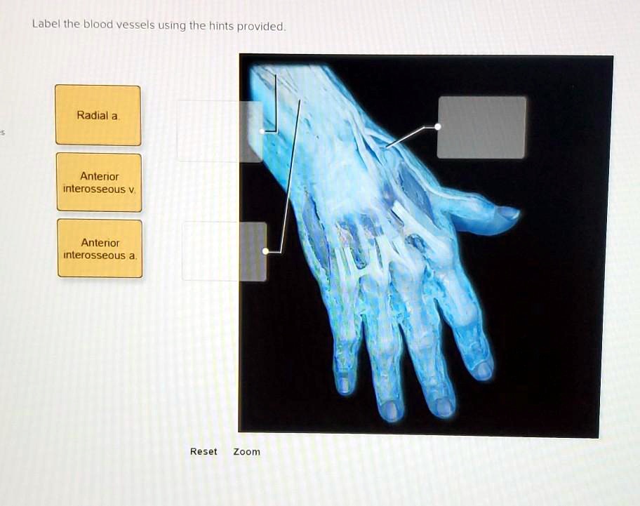 SOLVED: Label the blood vessels using the hints provided: Radial artery ...