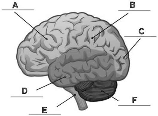 SOLVED: A lesion in the lobe labeled "B" would likely result in: a ...