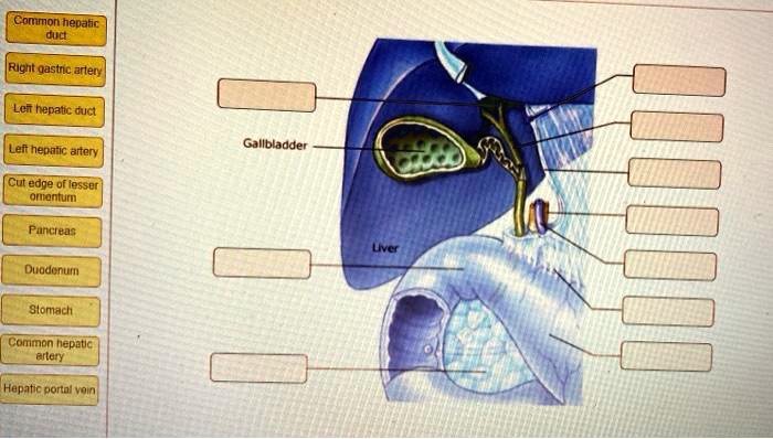 Common hepatic duct Right gastric artery Left hepatic duct Gallbladder ...