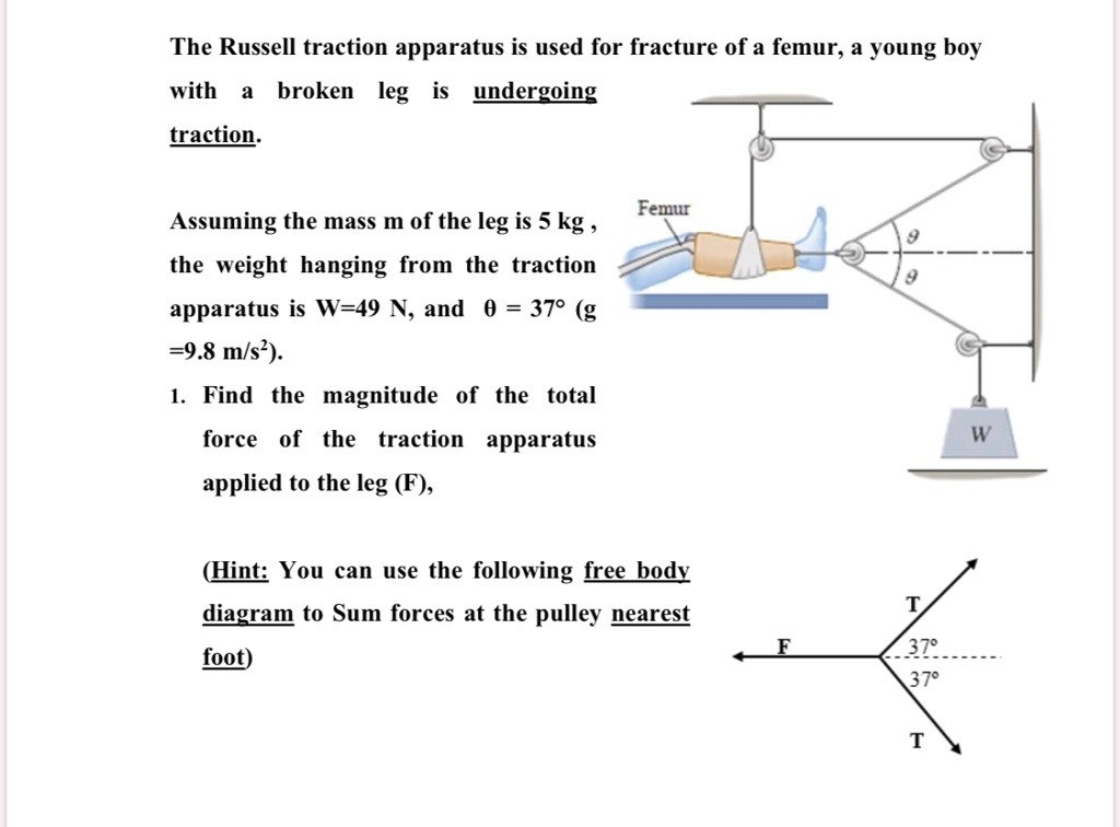 the russell traction apparatus is used for fracture of a femur a young ...