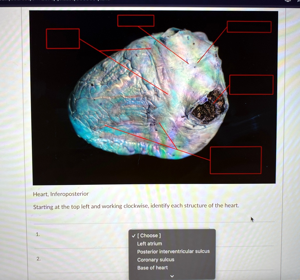 Thank you in advance. Heart, Inferoposterior Starting at the top left ...