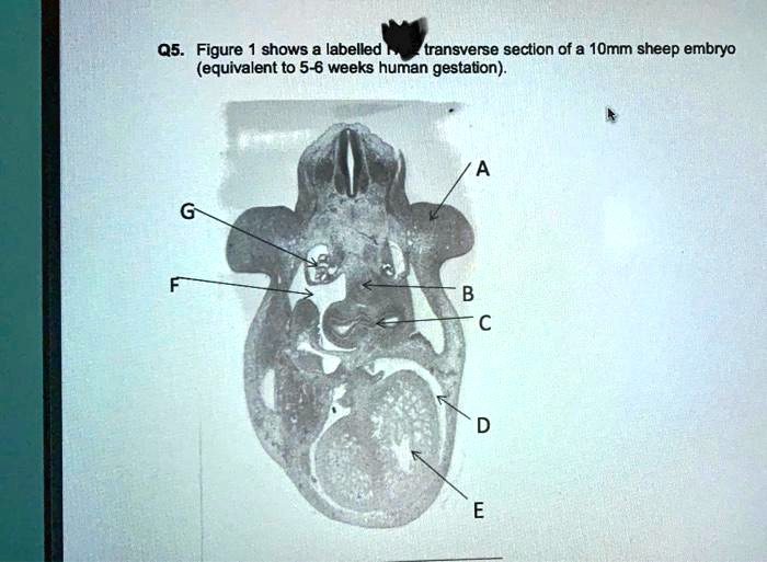 solved-05-figure-1-shows-labelled-transverse-section-of-a-1omm