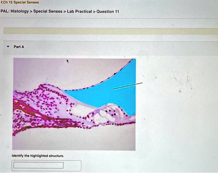 SOLVED: Texts: Special Senses > Lab Practical > Question 11 Part A ... SOLVED: Texts: Special Senses > Lab Practical > Question 11 Part A ...