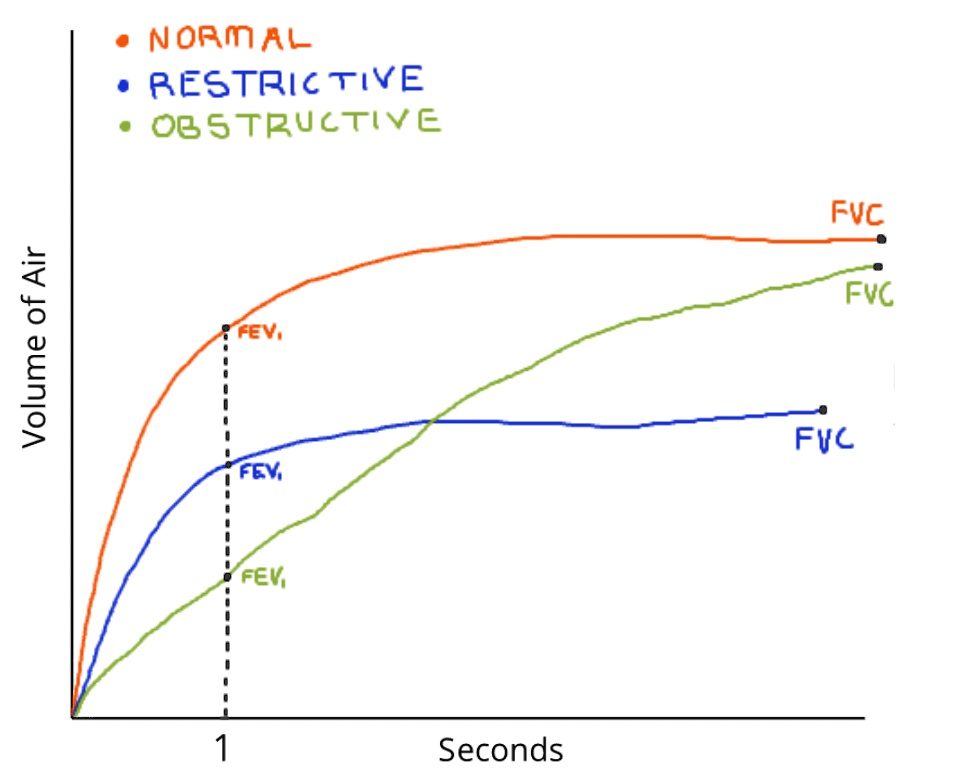 Volume of Air • NORMAL • RESTRICTIVE • OBSTRUCTIVE FVC FVC FEV1 FVC ...