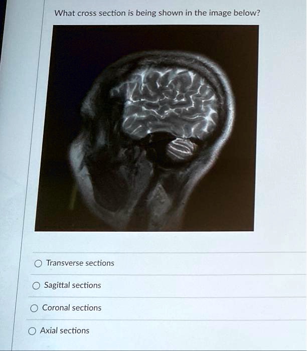 What cross section is being shown in the image...
