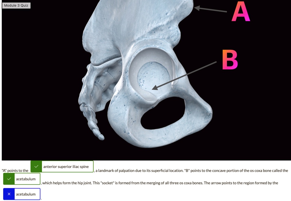 Module 3 Quiz A B "A" points to the anterior superior iliac spine , a ...