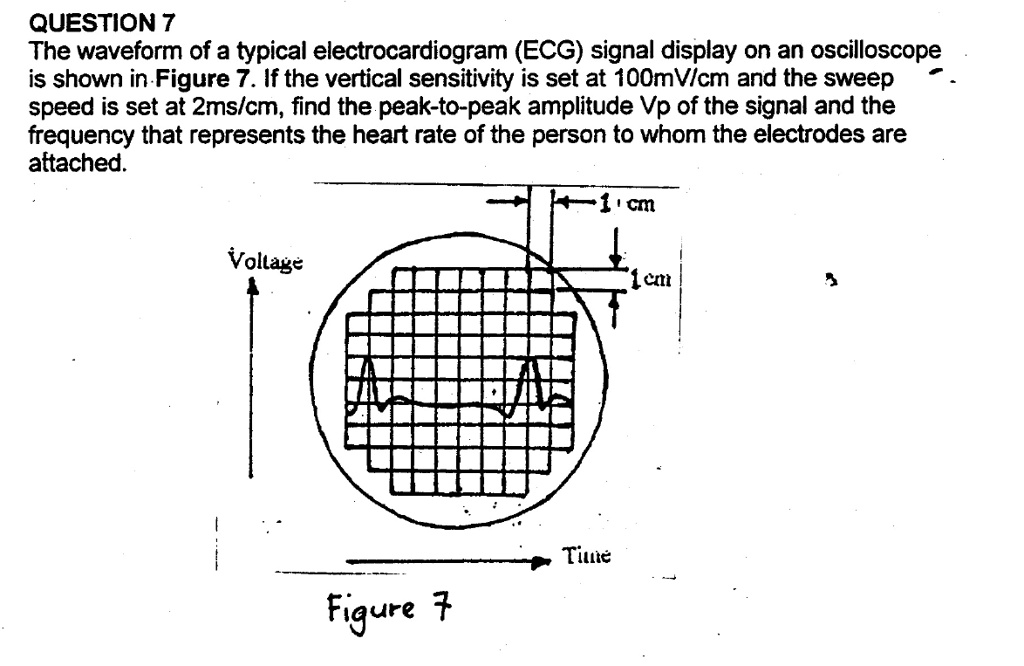 SOLVED: QUESTION 7: The waveform of a typical electrocardiogram (ECG) signal displayed on an ...