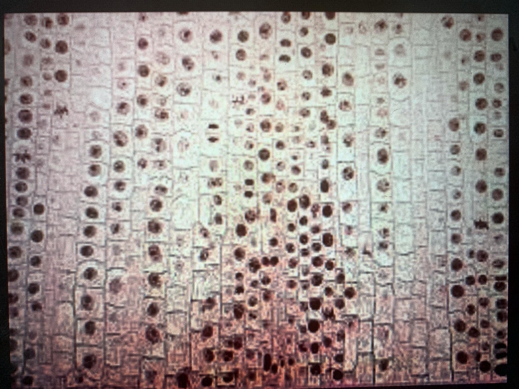 SOLVED count How Many Cells Are In This Picture