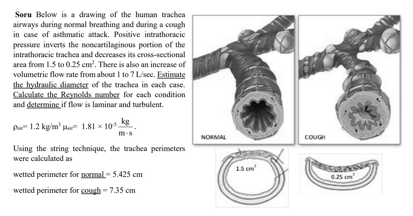 Soru Below is a drawing of the human trachea airways during normal ...