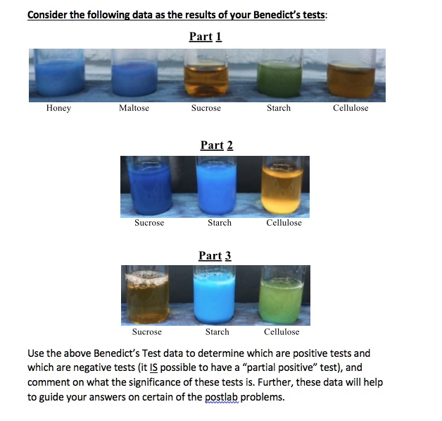 consider the following data as the results ot your benedicts tests part ...