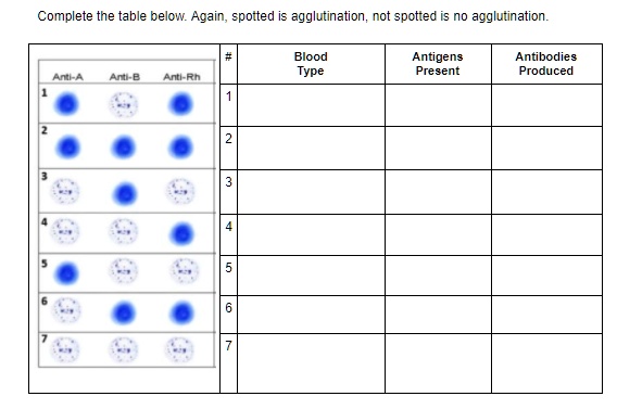 SOLVED: Complete the table below: Again pointed agglutination, not ...