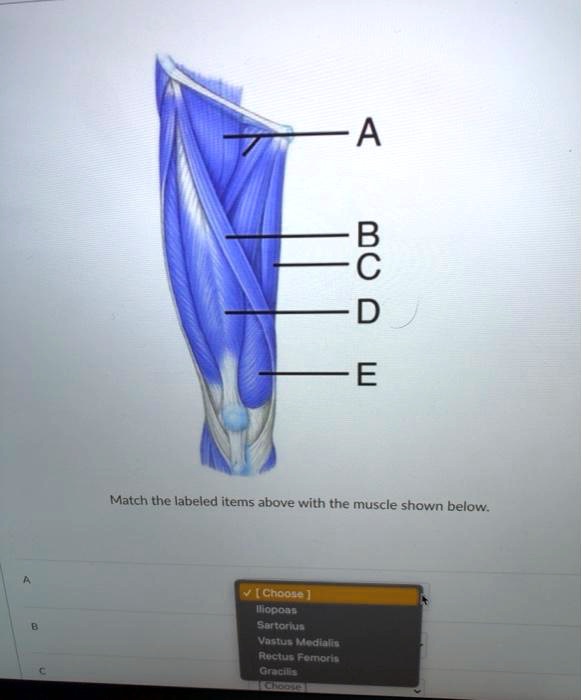 SOLVED: Match the labeled items above with the muscles shown below ...