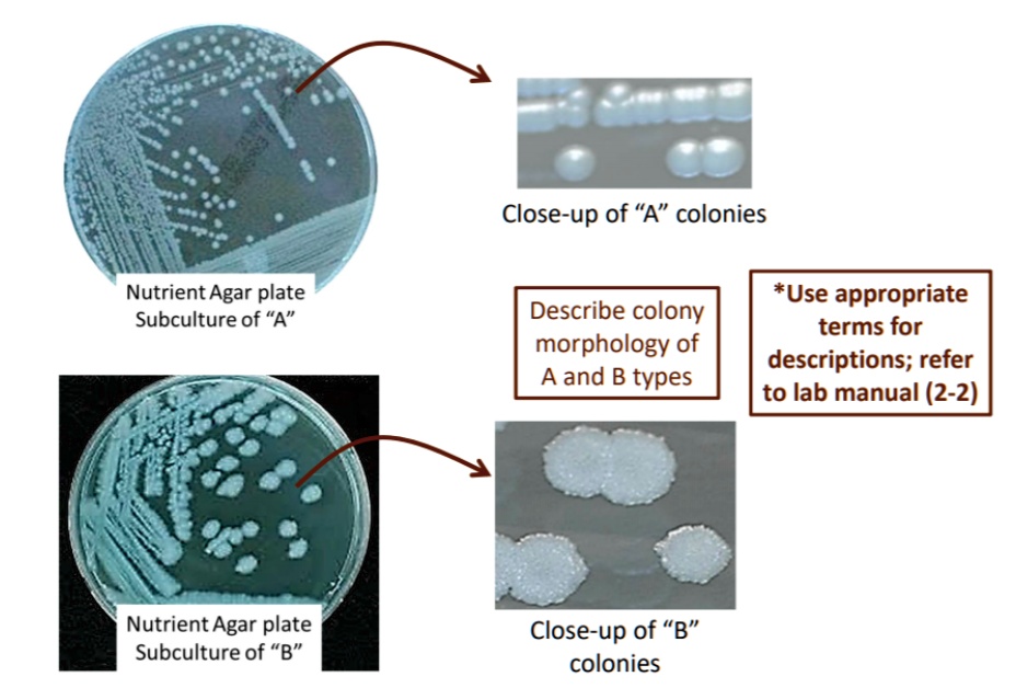 close up of a colonies nutrient agar plate subculture of a use ...