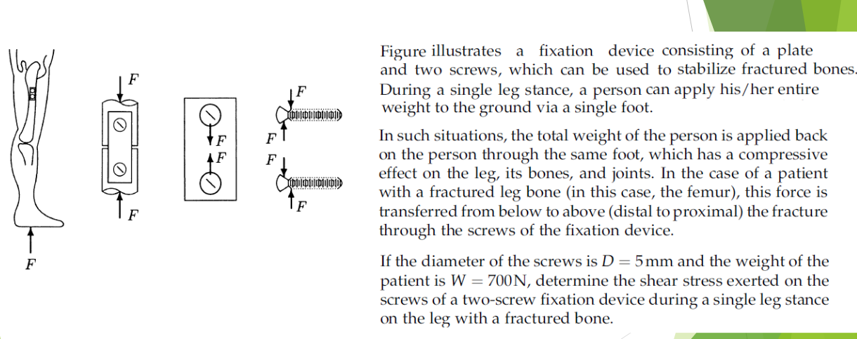 Figure illustrates a fixation device consisting of a plate and two ...