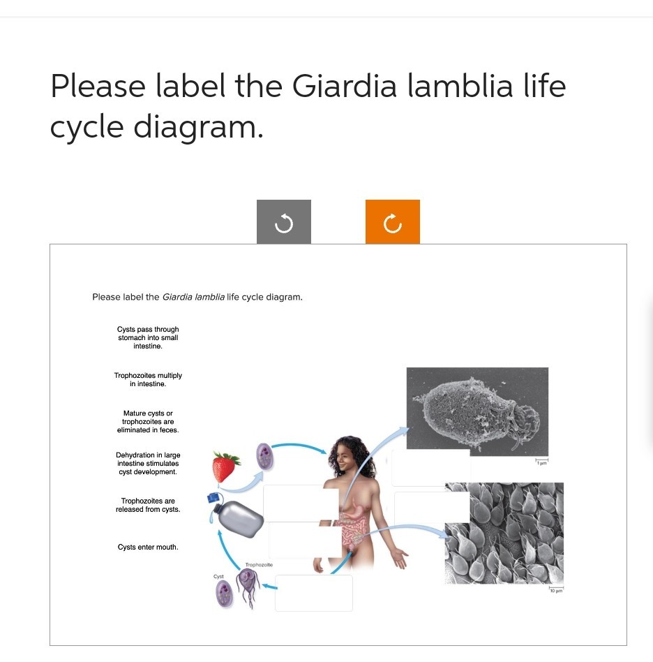 Please label the Giardia lamblia life cycle diagram. Please label the ... Please label the Giardia lamblia life cycle diagram. Please label the ...