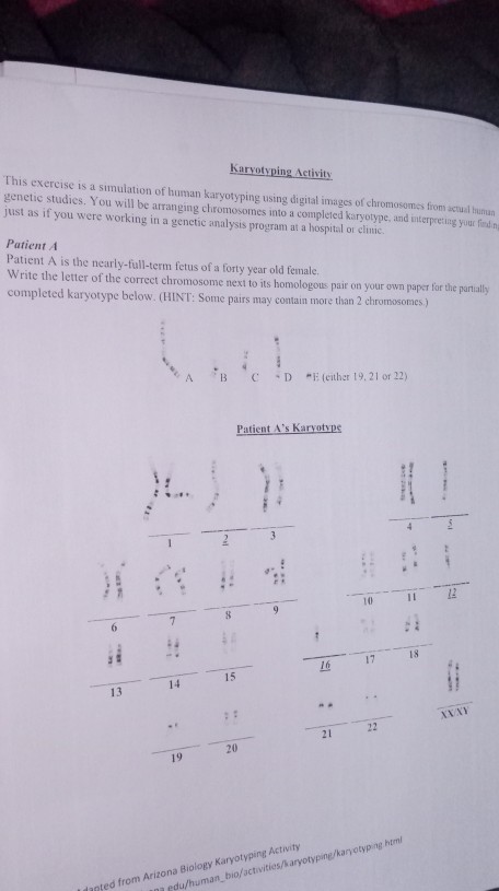 Karyotyping Activity This exercise is a simulation of human karyotyping ...