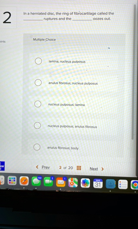 in a herniated disc the ring of fibrocartilage called the ruptures and ...