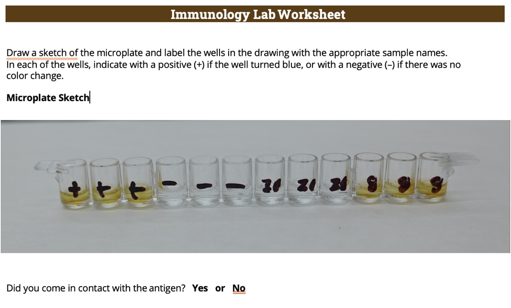 Immunology Lab Worksheet Did you come in contact with the antigen? Yes ...