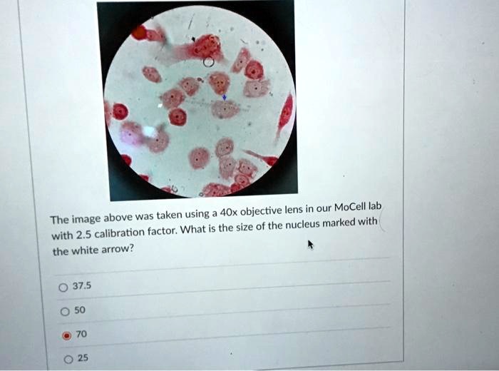 SOLVED: The image above was taken using a 40x objective lens in our MoCell lab with 2.5 ...