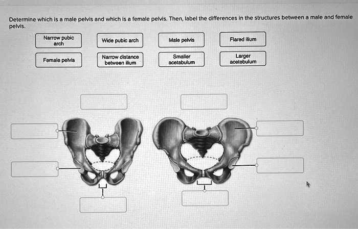 SOLVED: Determine which is a male pelvis and which is a female pelvis ...