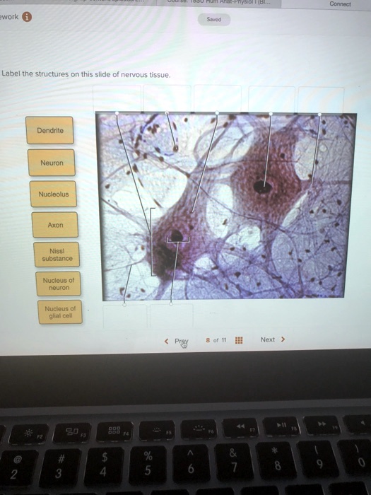 SOLVED: Connect work Saved Label the structures on this slide of ...